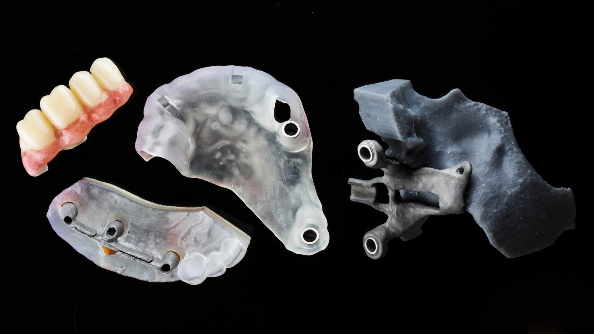 Come funziona l'impianto dentale? Guida per i pazienti