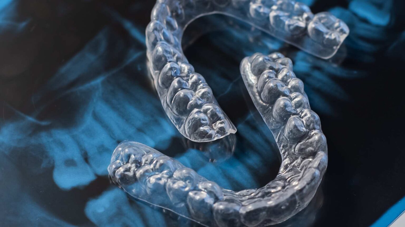 Come funziona l'apparecchio trasparente (aggiornato al 2025)