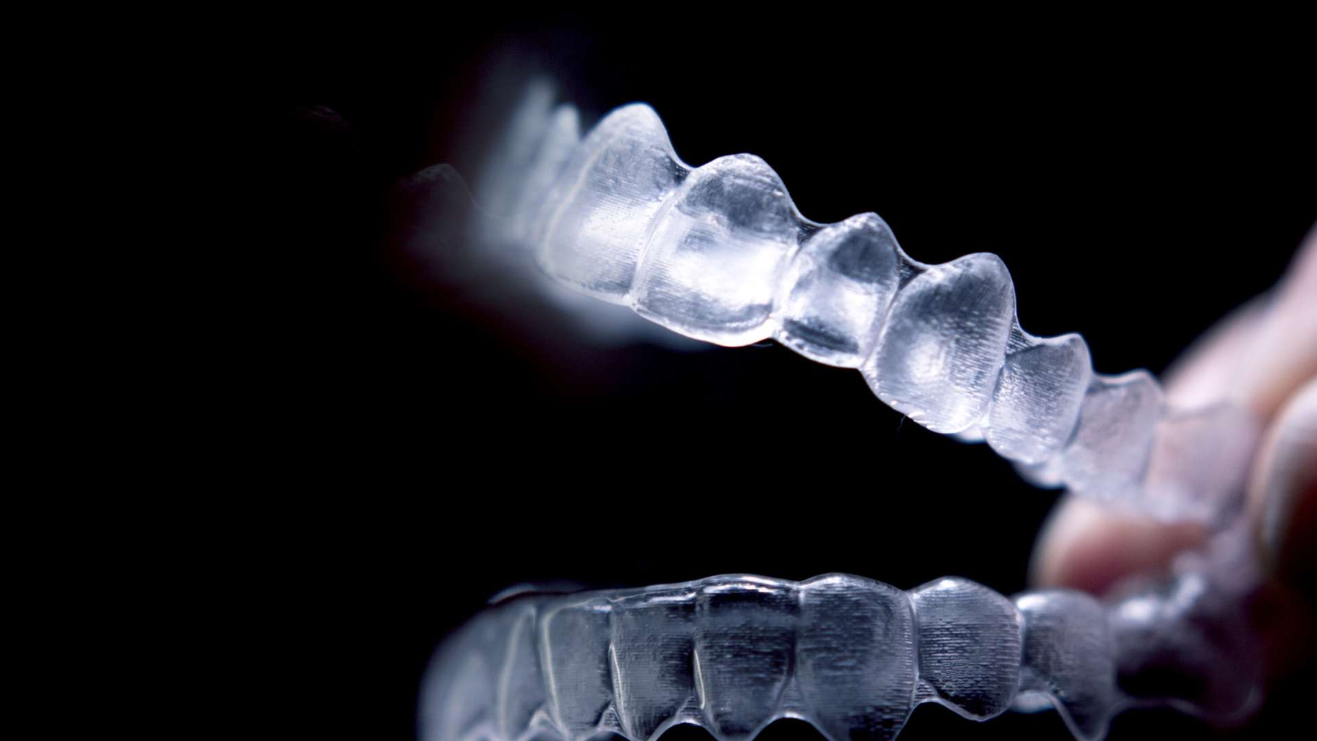 Quanto costa l'apparecchio trasparente (aggiornato al 2025)